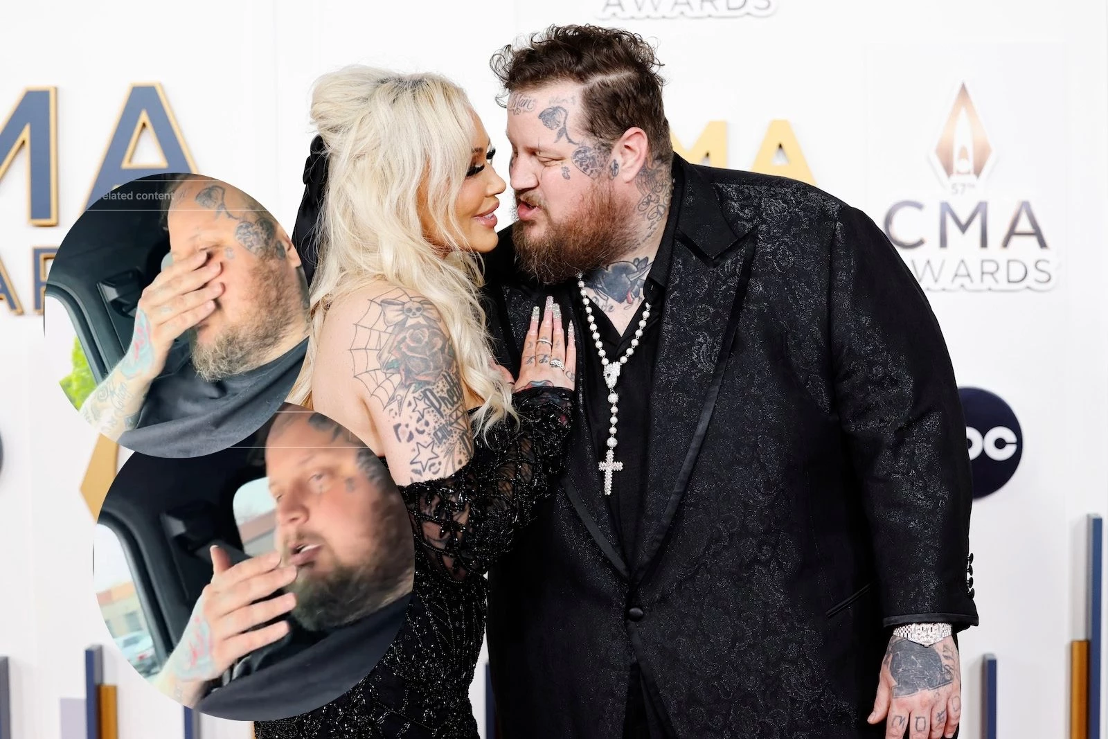 Jelly Roll Gets a Little Naughty After Dental Work, Anesthesia | DRGNews