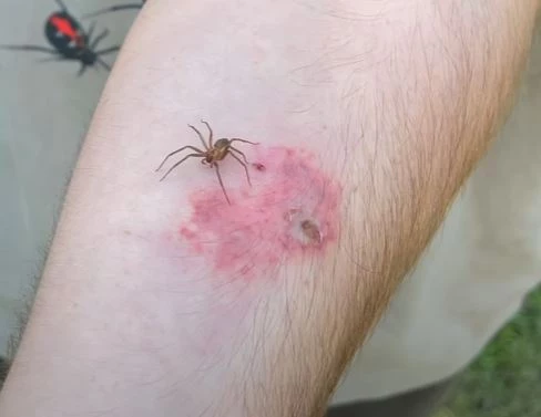 Your Lawn Could Be Attracting This Deadly Spider in IA & IL